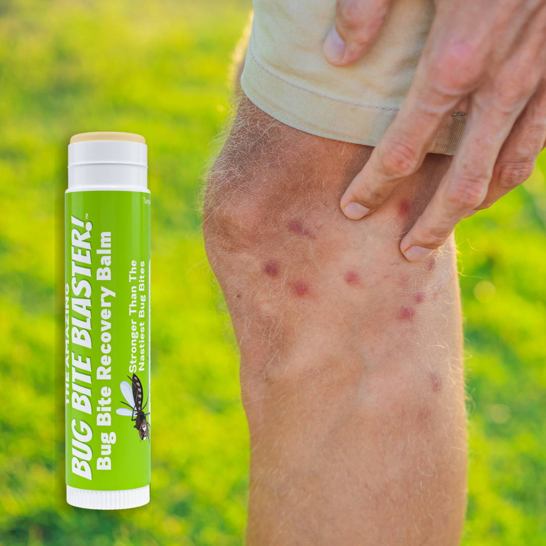 PRODUCT INFORMATION – Bug Bite Blaster